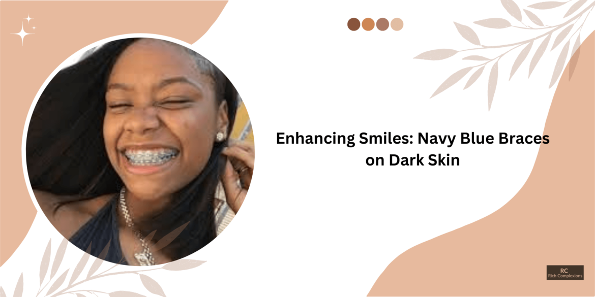 Enhancing Smiles: Navy Blue Braces on Dark Skin - Rich Complexions